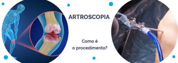 O que é Astroscopia, entendo como é o procedimento